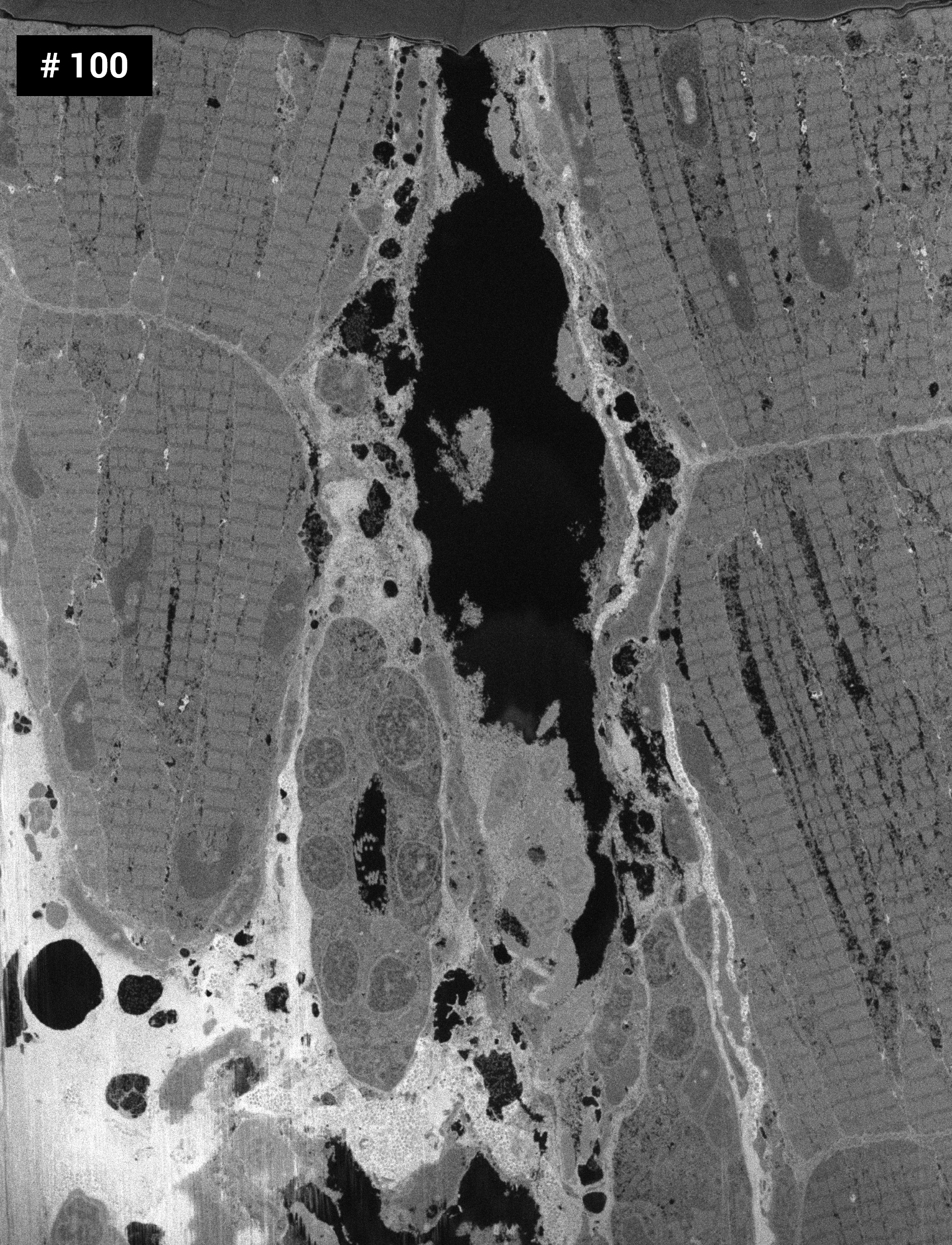 Embryo Mapping with Xe Plasma FIB-SEM Tomography | Tescan