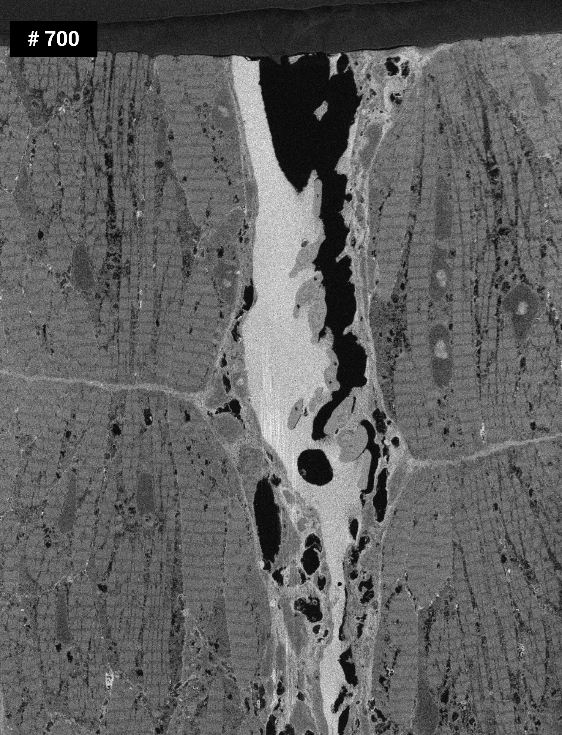 Embryo Mapping with Xe Plasma FIB-SEM Tomography | Tescan