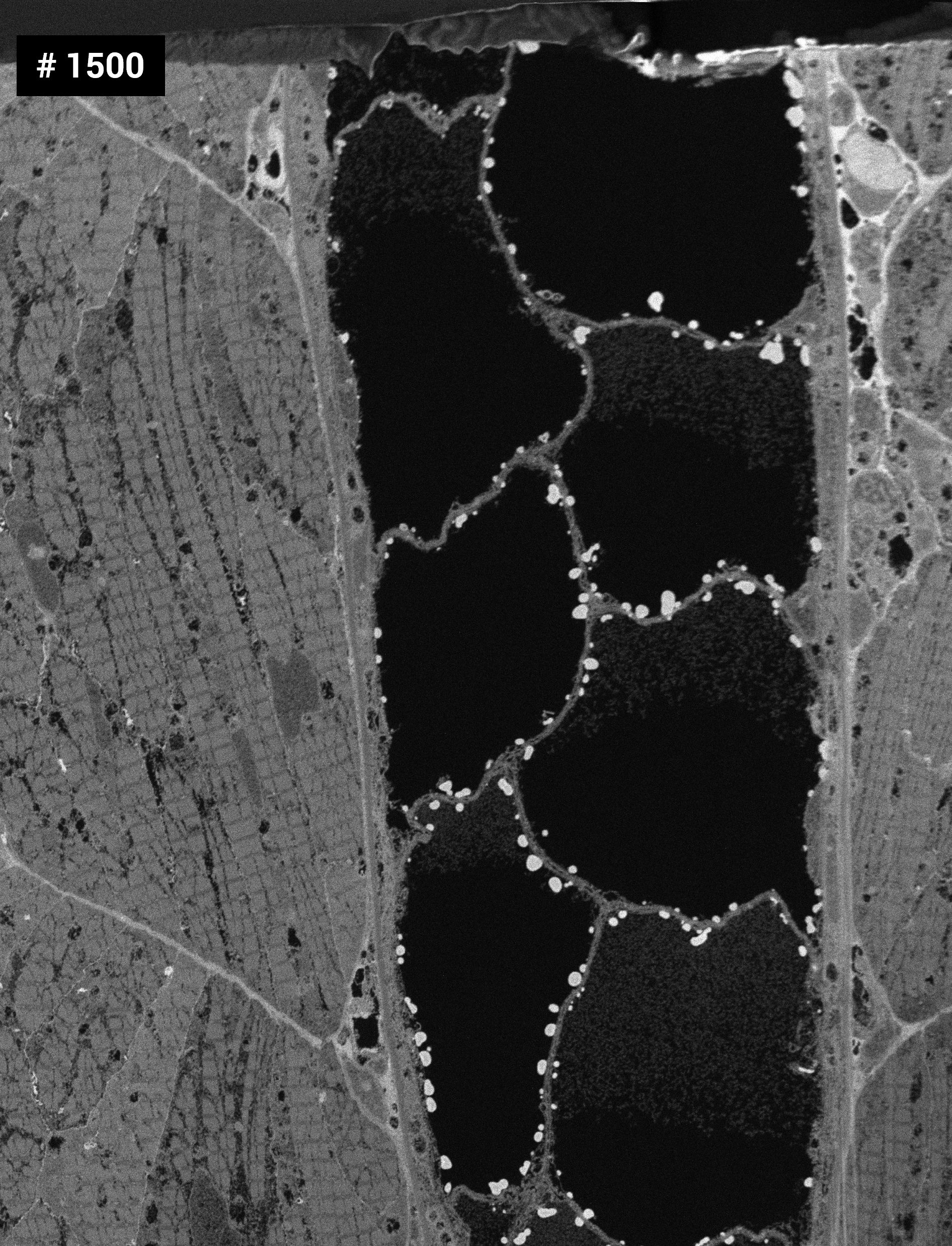 Embryo Mapping with Xe Plasma FIB-SEM Tomography | Tescan